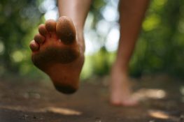Runner’s Toe: Preventing And Treating Black Toenails